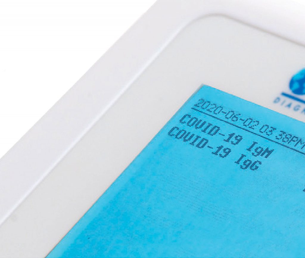 DPP® Micro Reader II – Chembio Diagnostics Brazil