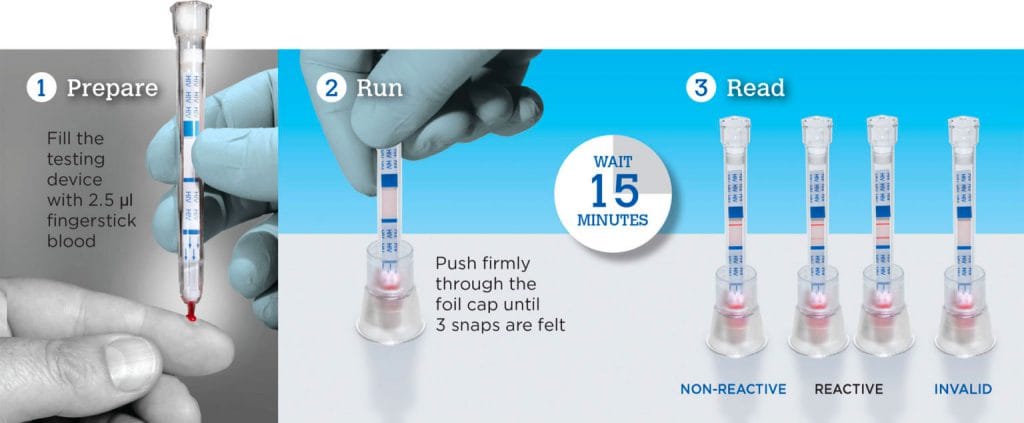 SURE CHECK® HIV 1/2 Brazil – Chembio Diagnostics Brazil